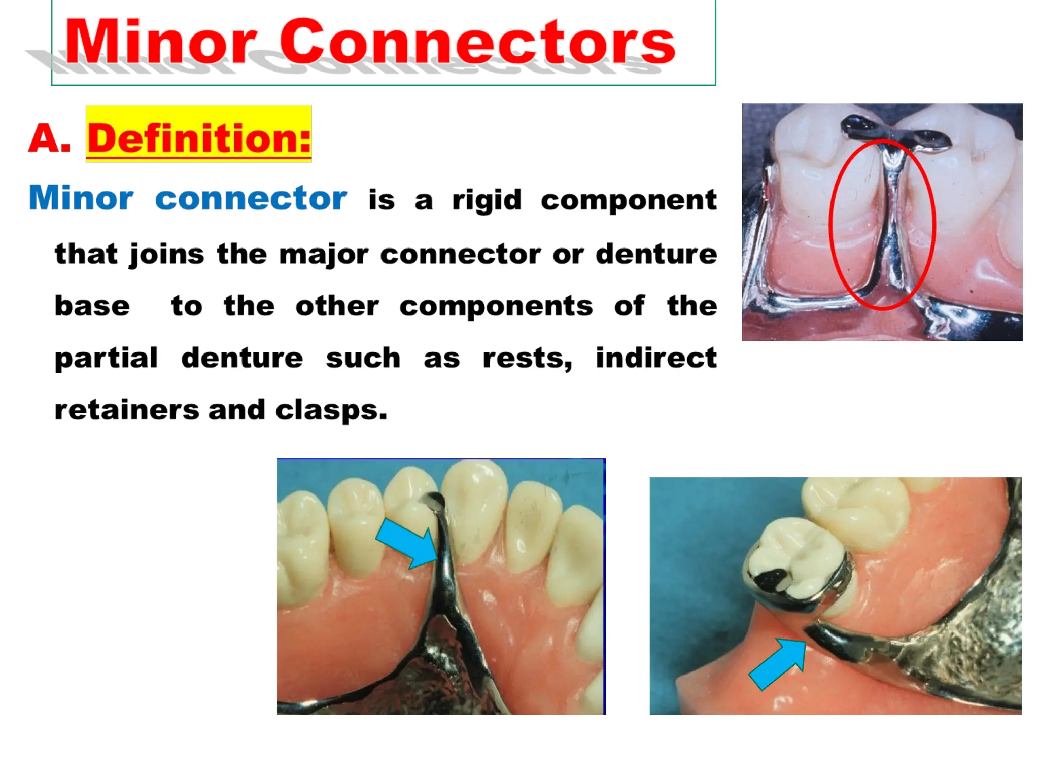 5. Minor connectors Removable partial denture.ppt