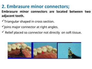 5. Minor connectors Removable partial denture.ppt