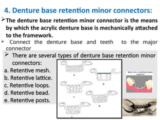 5. Minor connectors Removable partial denture.ppt