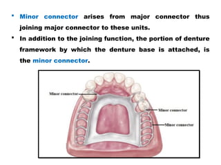 5. Minor connectors Removable partial denture.ppt