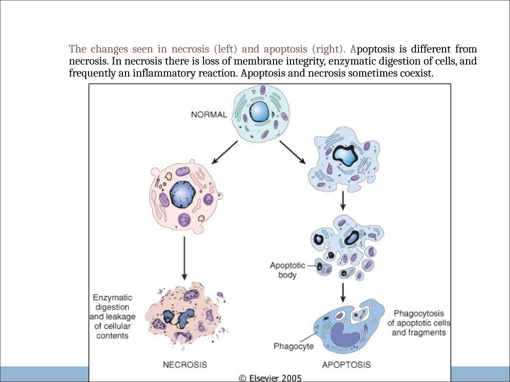 5. cell injury...APOPTOSIS ppt.programmed cell death | PPT
