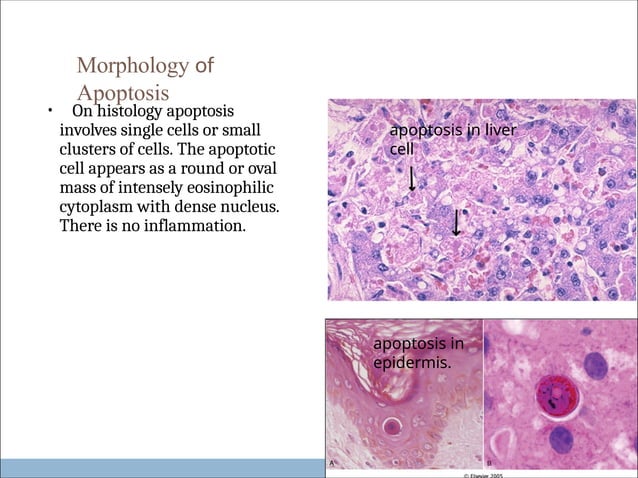 5. cell injury...APOPTOSIS ppt.programmed cell death | PPT