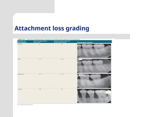 5. Plaque consequences classification.pptx