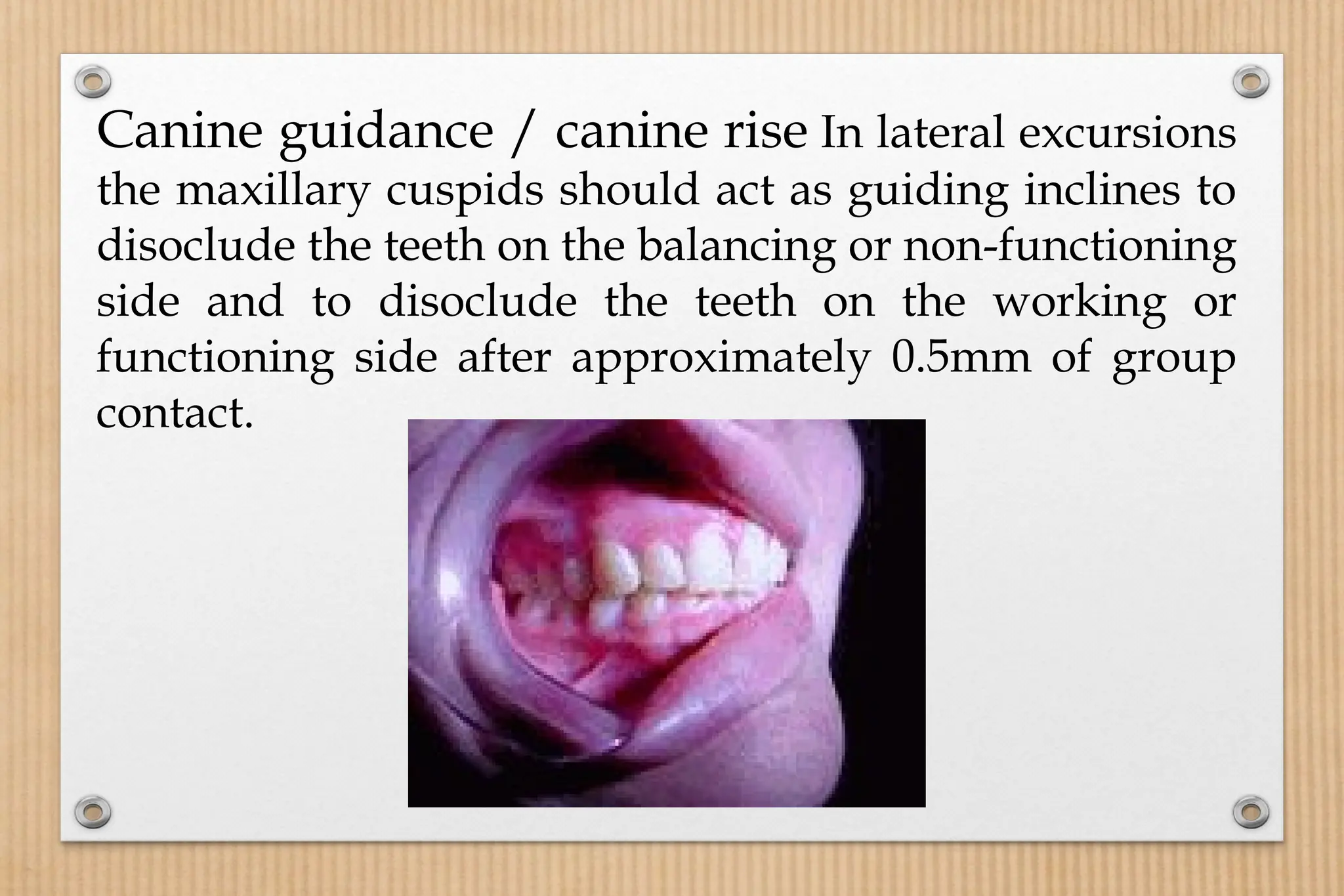 5. ROTH PHILOSOPHY.ppt orthodontics, biomechanics , | PPT