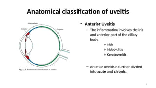 5.opththalmology Uveitis.over view pptx | PPT