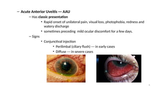 5.opththalmology Uveitis.over view pptx | PPT