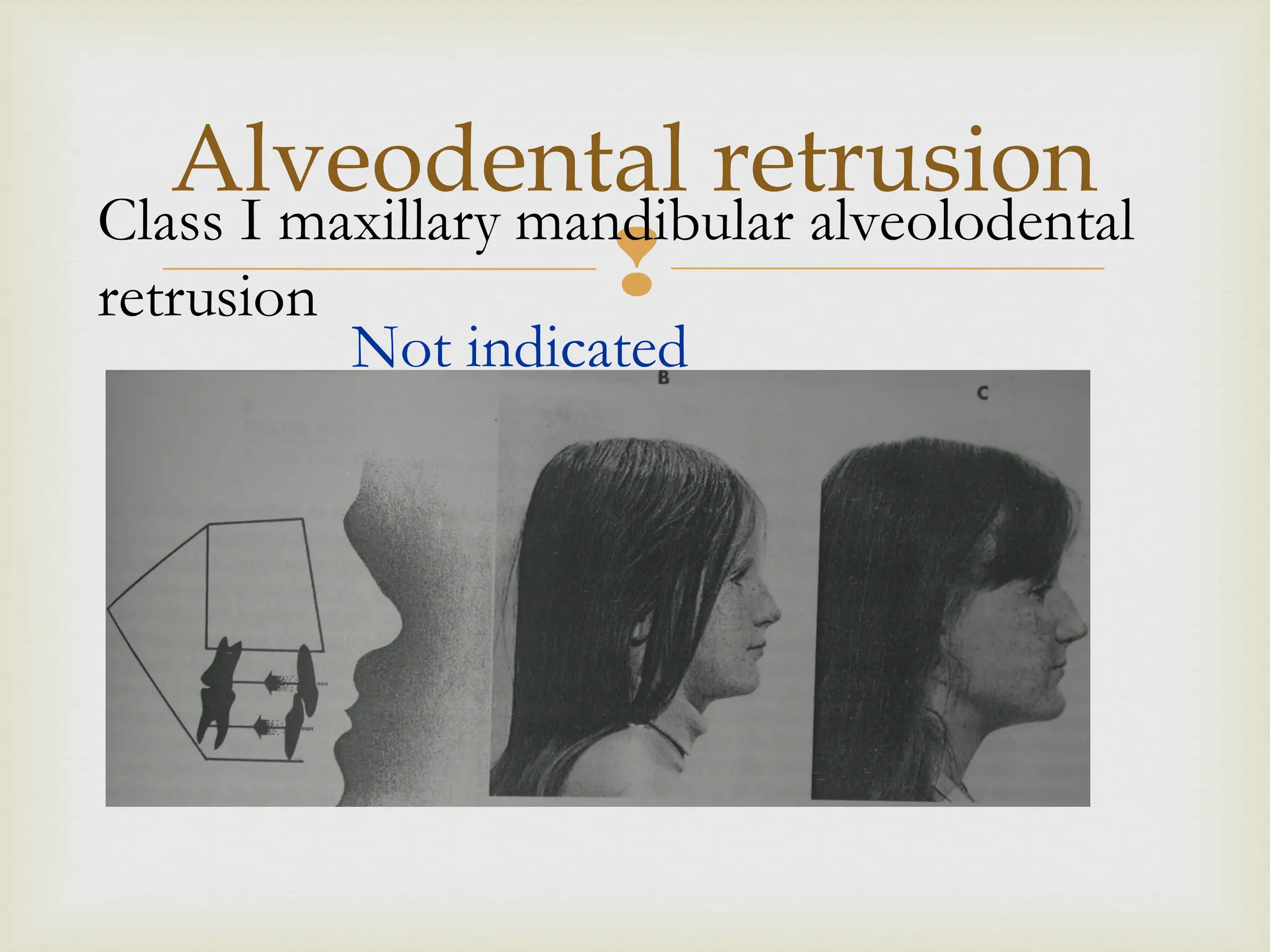 5.SERIAL EXTRACTION.ppt lecture class.ppt