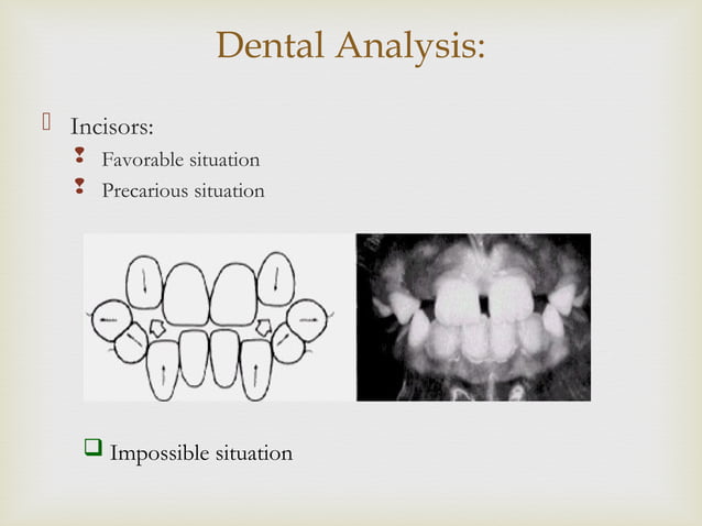 5.SERIAL EXTRACTION.ppt lecture class.ppt