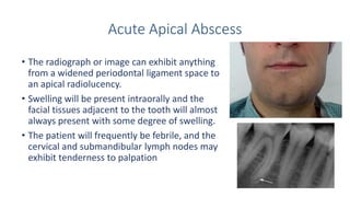 5. periodontal diseases and etiology.pdf