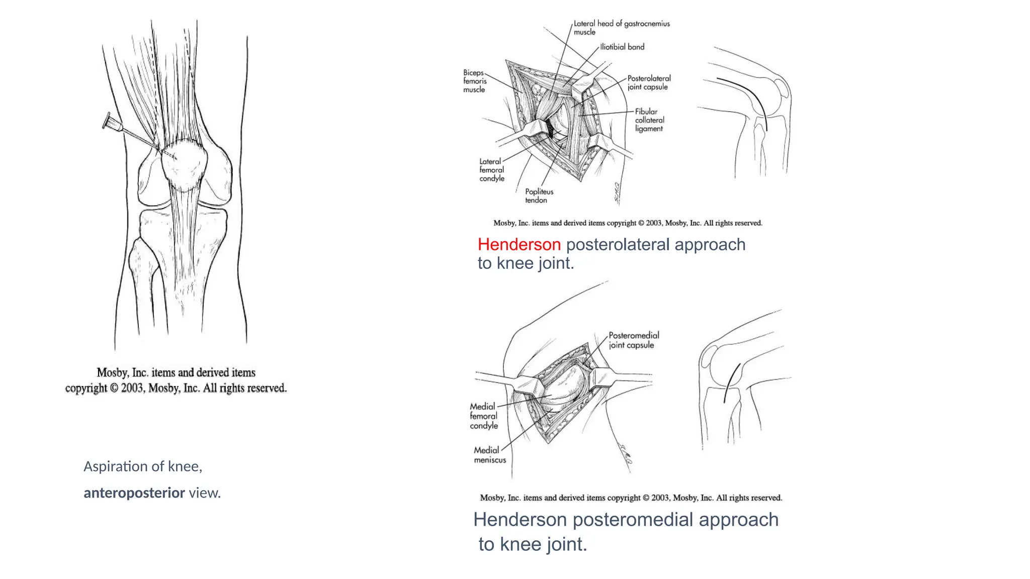 5. SEPTIC ARTHRITIS TZ.pptxAGCBJHZXBJJHCJZ | PPTX