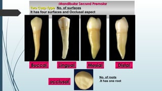 5. Lec CONS Mandibular second premolar.ppt