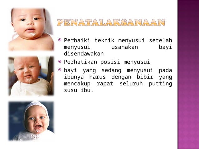 5. REGURGITASI.ppt yang terjadi pada neo | PPT