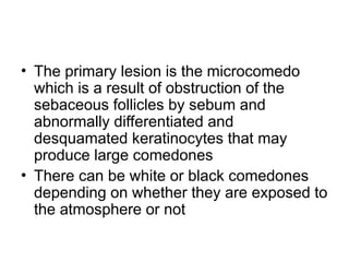 5. ACNE AND ACNEIFORM ERUPTIONS.ppt slid share | PPT