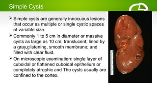 5.polycystic kidney diseasesnobstruction | PPTX