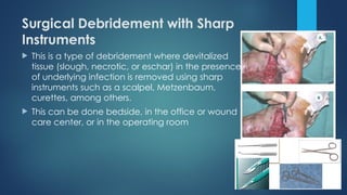 5. Principle of Debridement[1]-1.pptx..... | PPTX
