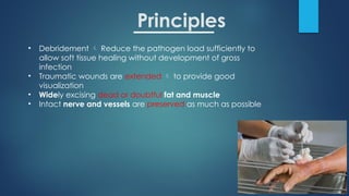 5. Principle of Debridement[1]-1.pptx..... | PPTX