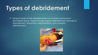 5. Principle of Debridement[1]-1.pptx..... | PPTX