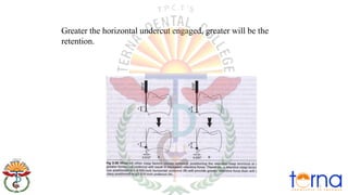 5.-direct-retainers in maxillofacial prosthodontics and removal ...