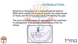 5.-direct-retainers in maxillofacial prosthodontics and removal ...