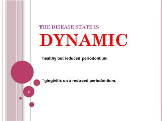 Reduced but healthy periodontium …………….. | PPTX