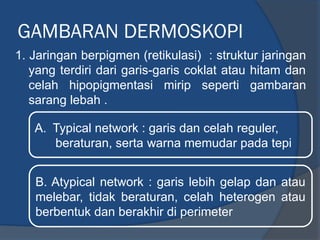 5. GAMBARAN DERMOSKOPI PADA KASUS EFLORESENSI | PPTX