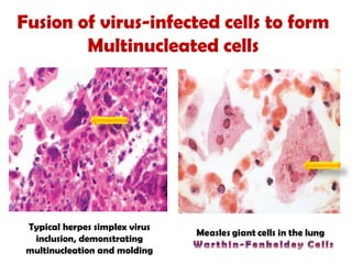 5-2 Viral Pathogenesis & Laboratory Diagnosis.ppt