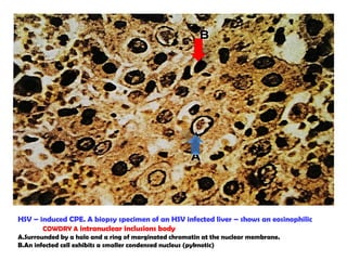 5-2 Viral Pathogenesis & Laboratory Diagnosis.ppt