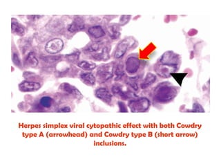 5-2 Viral Pathogenesis & Laboratory Diagnosis.ppt