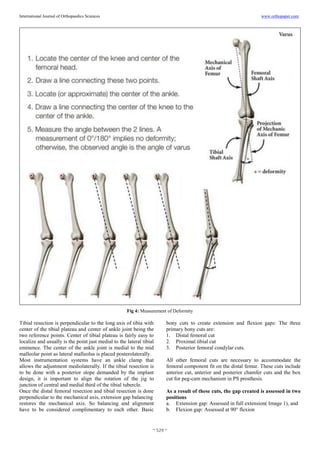 Osteoarthritis | PDF
