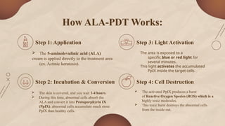 5-aminolevulinic acid (ALA) in Photodynamic therapy (PDT) | PPTX
