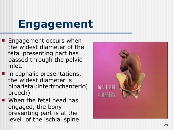 5.Anatomic Characteristics Of The Fetal Head And Maternal