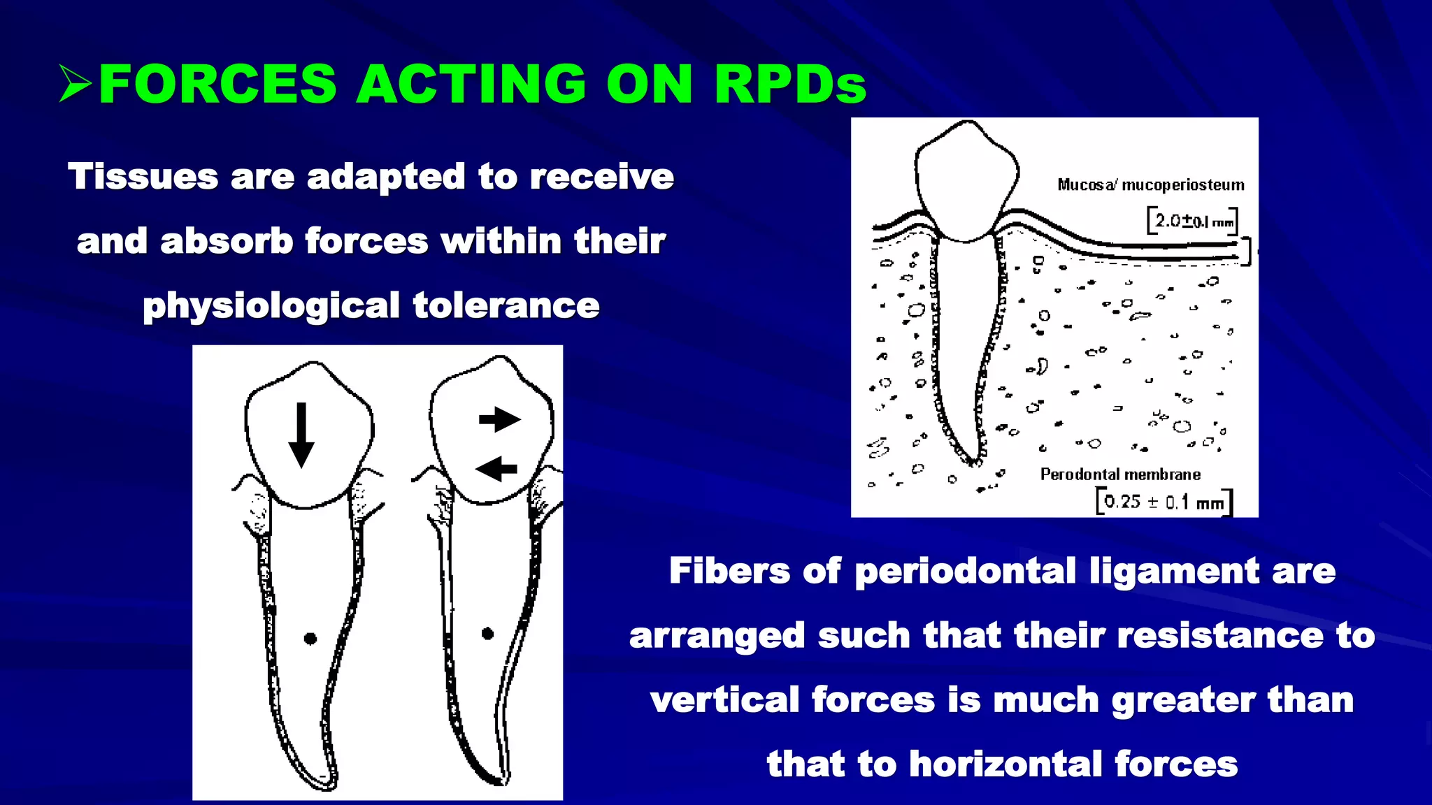 5- Basic principles for designing the removable partial denture class i ...