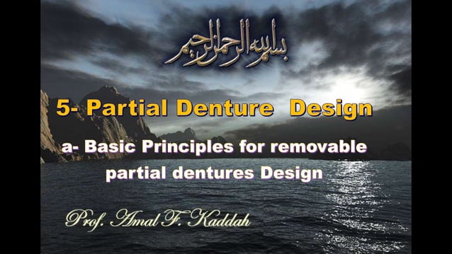 5- Basic principles for designing the removable partial denture class i ...