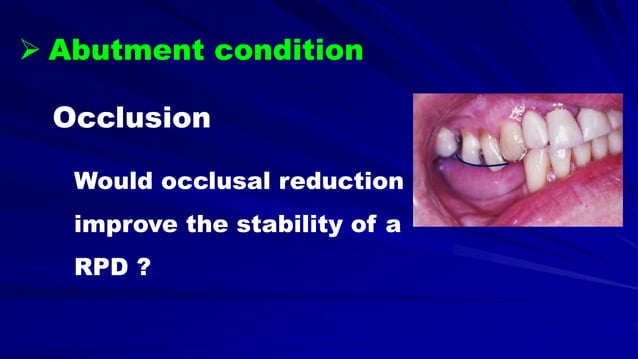 5- Basic principles for designing the removable partial denture (class ...