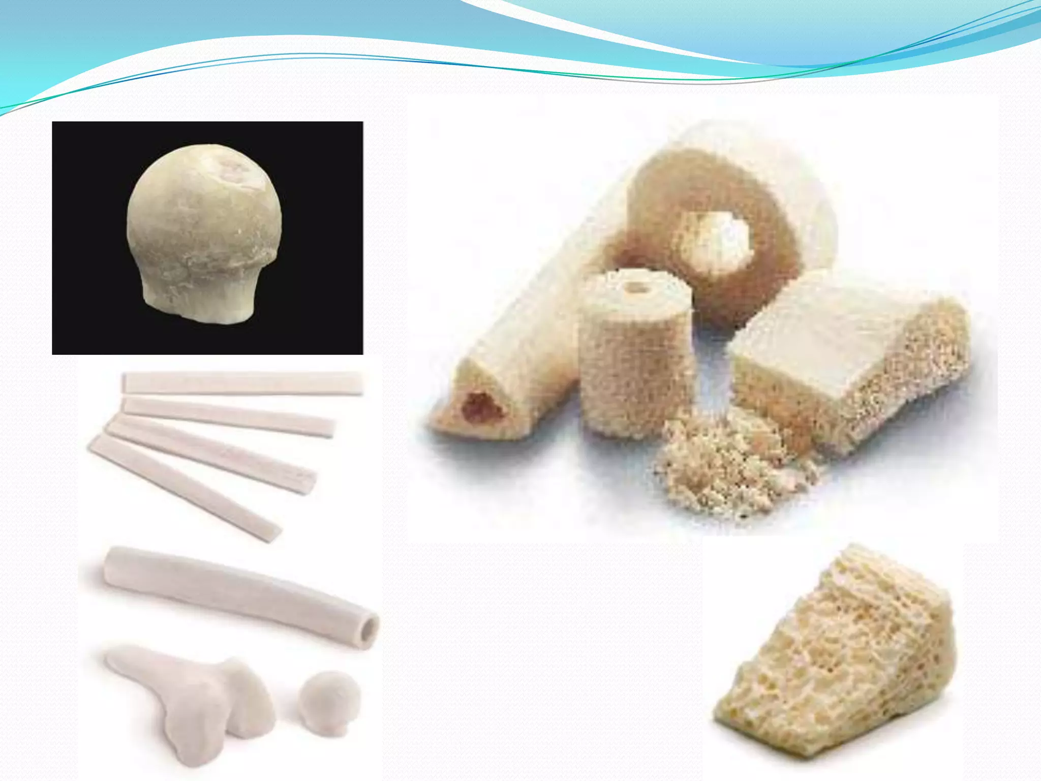 bone graft substitutes | PPT
