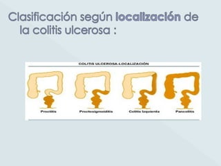 colitis ulcerosa dietoterapia | PPT
