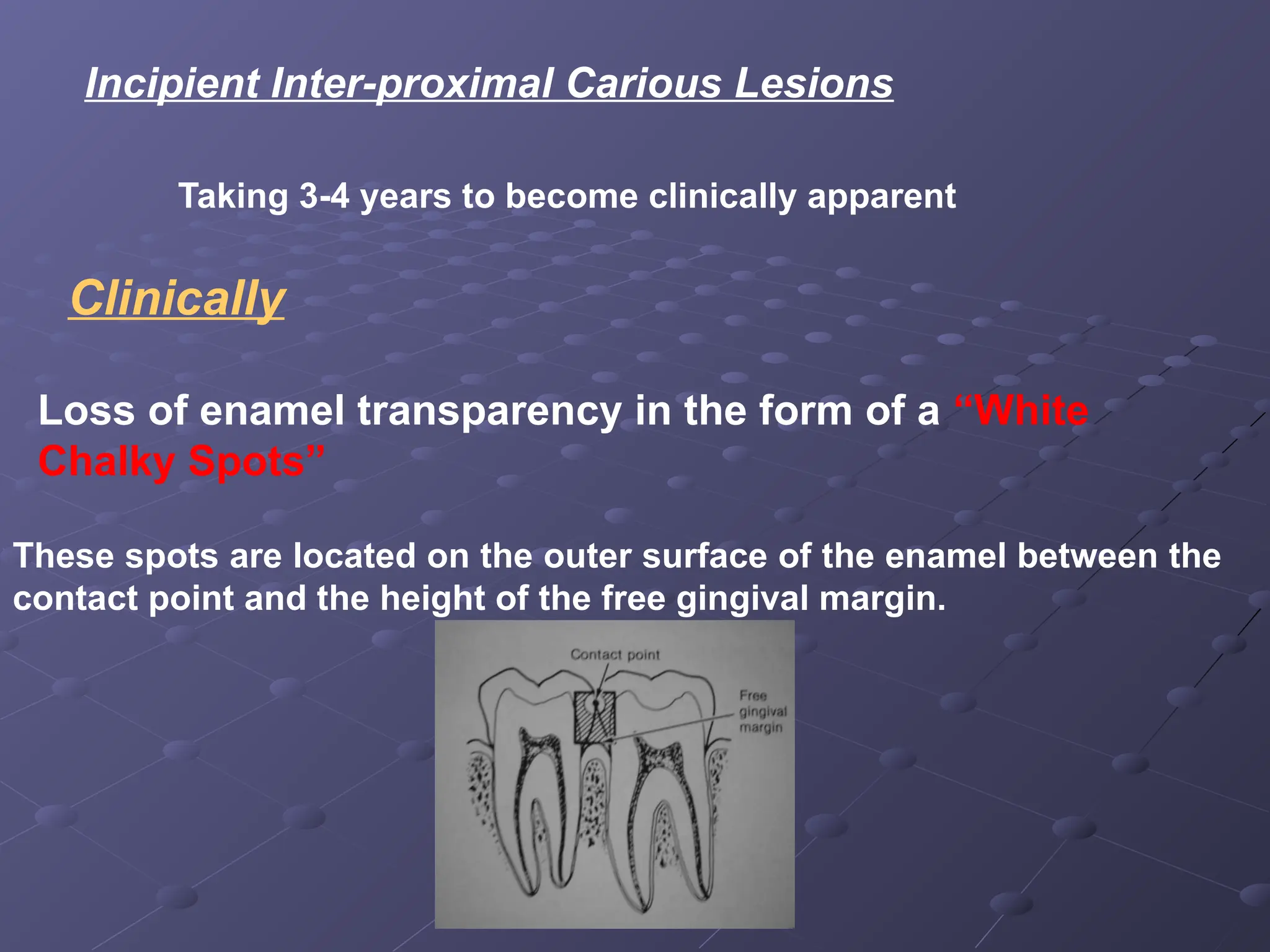 5-Dental Caries radiology in dentistry . | PPTX