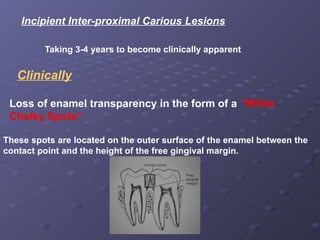5-Dental Caries radiology in dentistry . | PPTX