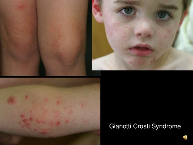 5. dermatological infections