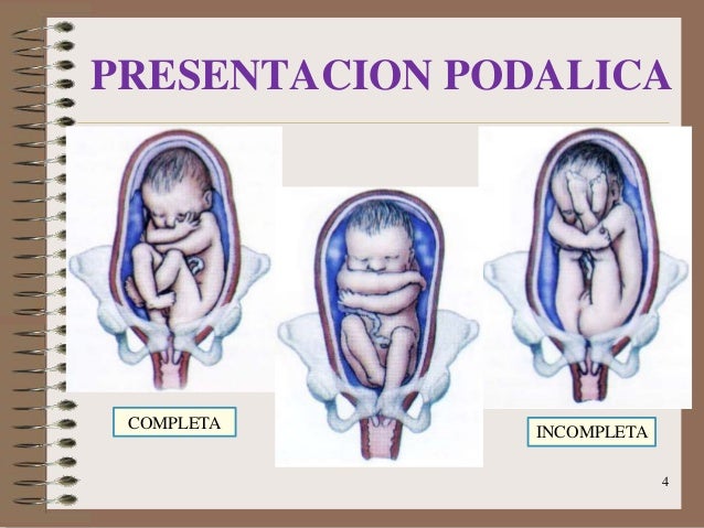 5 diagnostico de actitud fetal