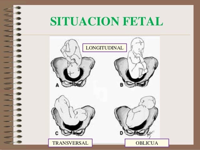 5 diagnostico de actitud fetal