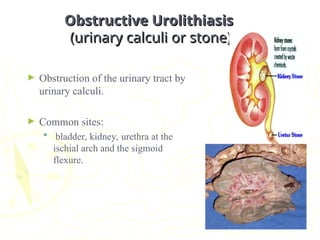 5-Disorders-of-Urinary-System.pptNephritis | PPT