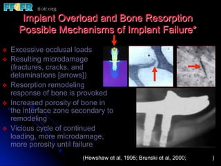 Edentulous Mandible - Fixed Prostheses | PDF
