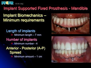 Edentulous Mandible - Fixed Prostheses | PDF
