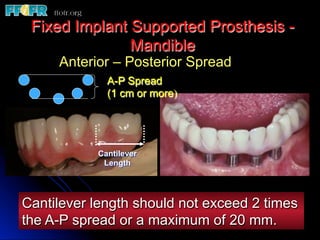 Edentulous Mandible - Fixed Prostheses | PDF