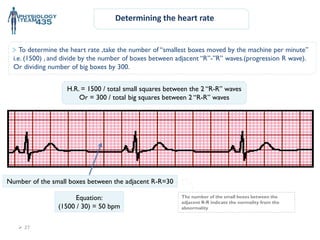 Electrocardiogram is a non-invasive test that measures the electrical ...