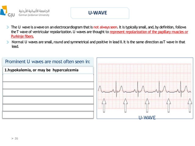 5-Electrocardiogram SSSASASASASA (1).pdf