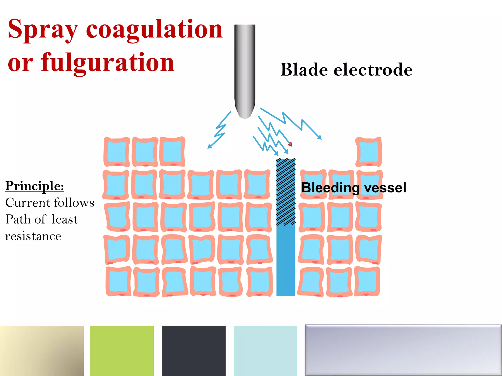 5 electrosurgery medical equipment | PDF