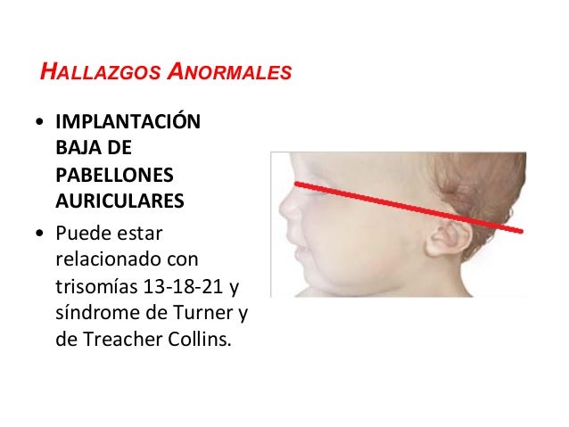 EXAMEN FÍSICO DEL NIÑO