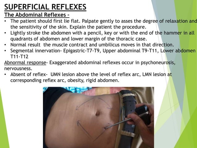 Part 5 examination of reflex | PPTX | Death, Injury, or Military ...
